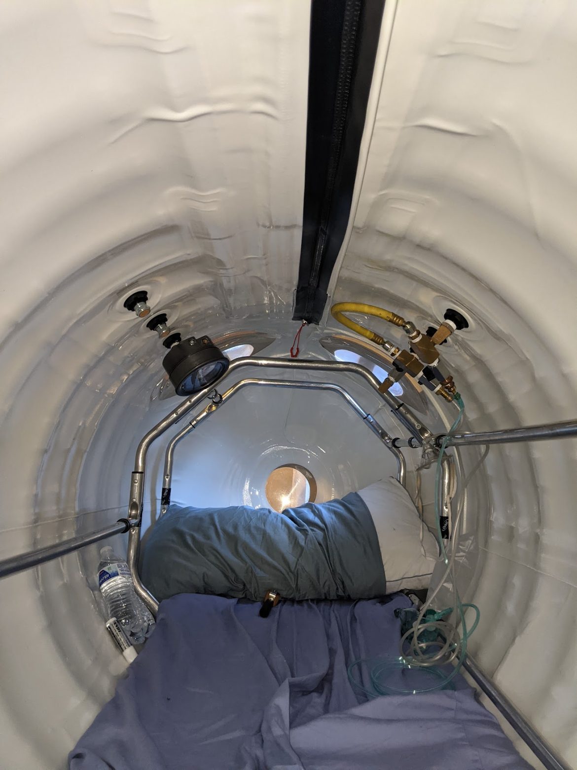 Hyperbaric Oxygen Therapy (HBOT) for Cancer – cancerV.me